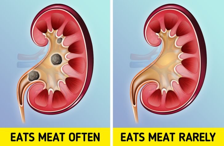 What Happens in Your Body If You Eat Too Much Meat – Habits & Routines
