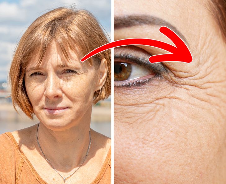 7 Everyday Habits that Give You Skin Wrinkles – Page 2 – Habits & Routines